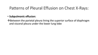 Pleural Effusion & Pneumothorax radiology made simple by Anish Dhakal ...