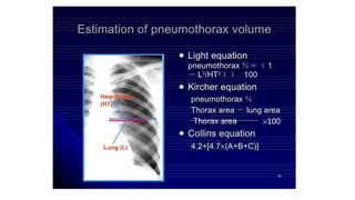 Pleural Effusion & Pneumothorax radiology made simple by Anish Dhakal ...