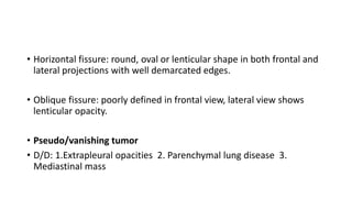 Approach in Pleural pathologies by Dr. Subash Pathak | PPTX