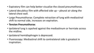 Approach in Pleural pathologies by Dr. Subash Pathak | PPTX