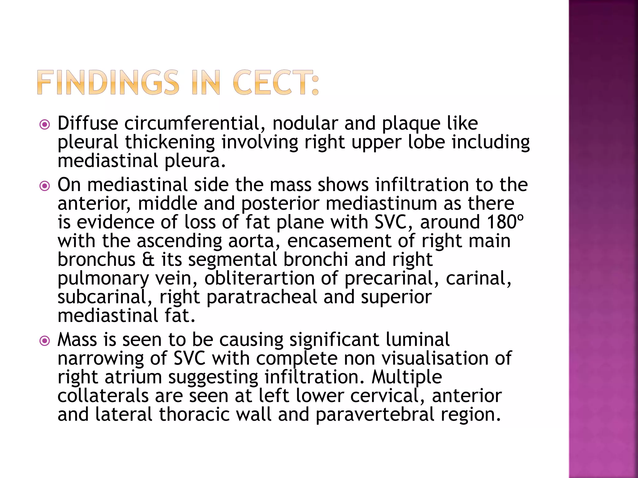 Imaging of Pleural tumors Dr Alekya | PPTX
