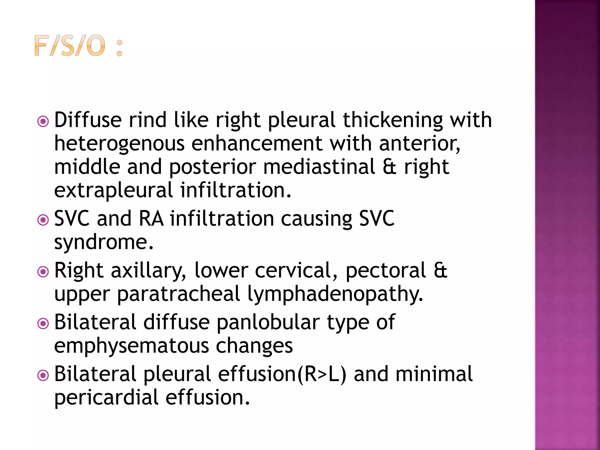 Imaging of Pleural tumors Dr Alekya | PPTX