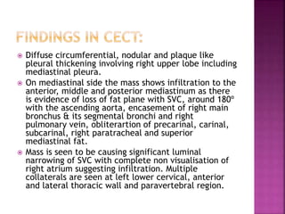 Imaging of Pleural tumors Dr Alekya | PPTX