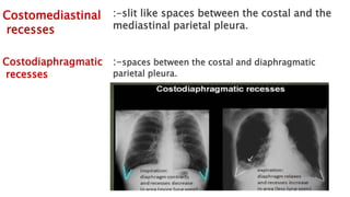 pleura of lungs.pptx