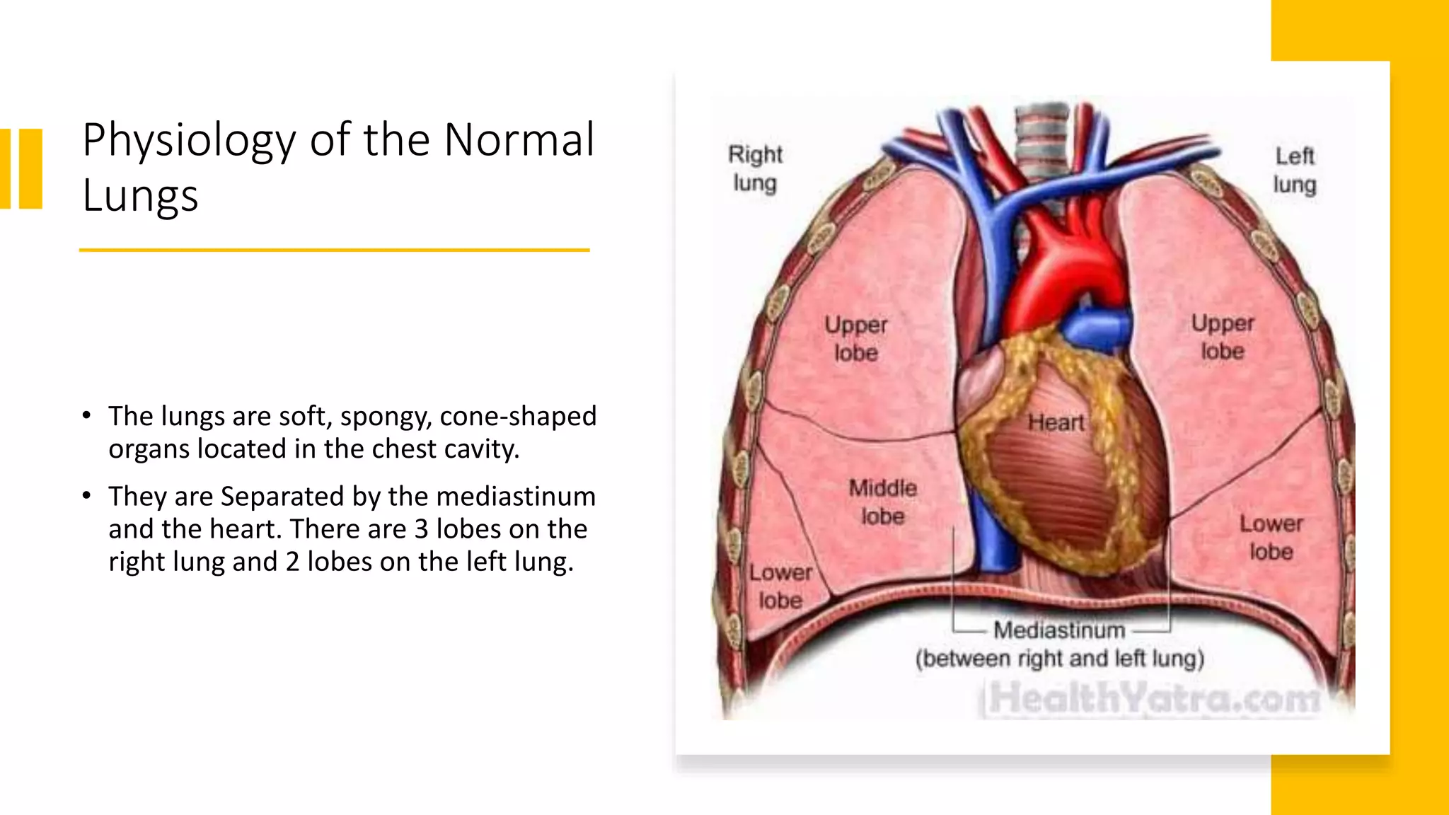 Pleurisy | PPTX