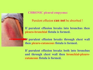 Pleurisy.ppt