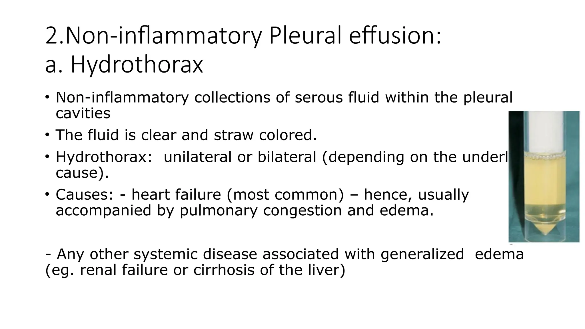 Pleurisy, Pleural effusion & pneumothorax.pptx