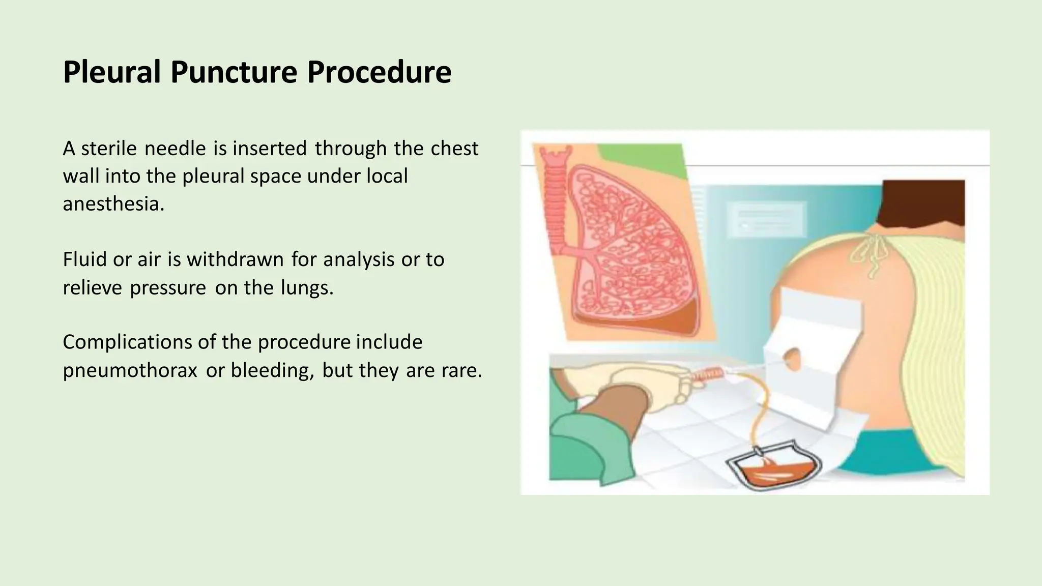 Pleuritis and pleural puncture ppt new by Tanu & Danish.pptx