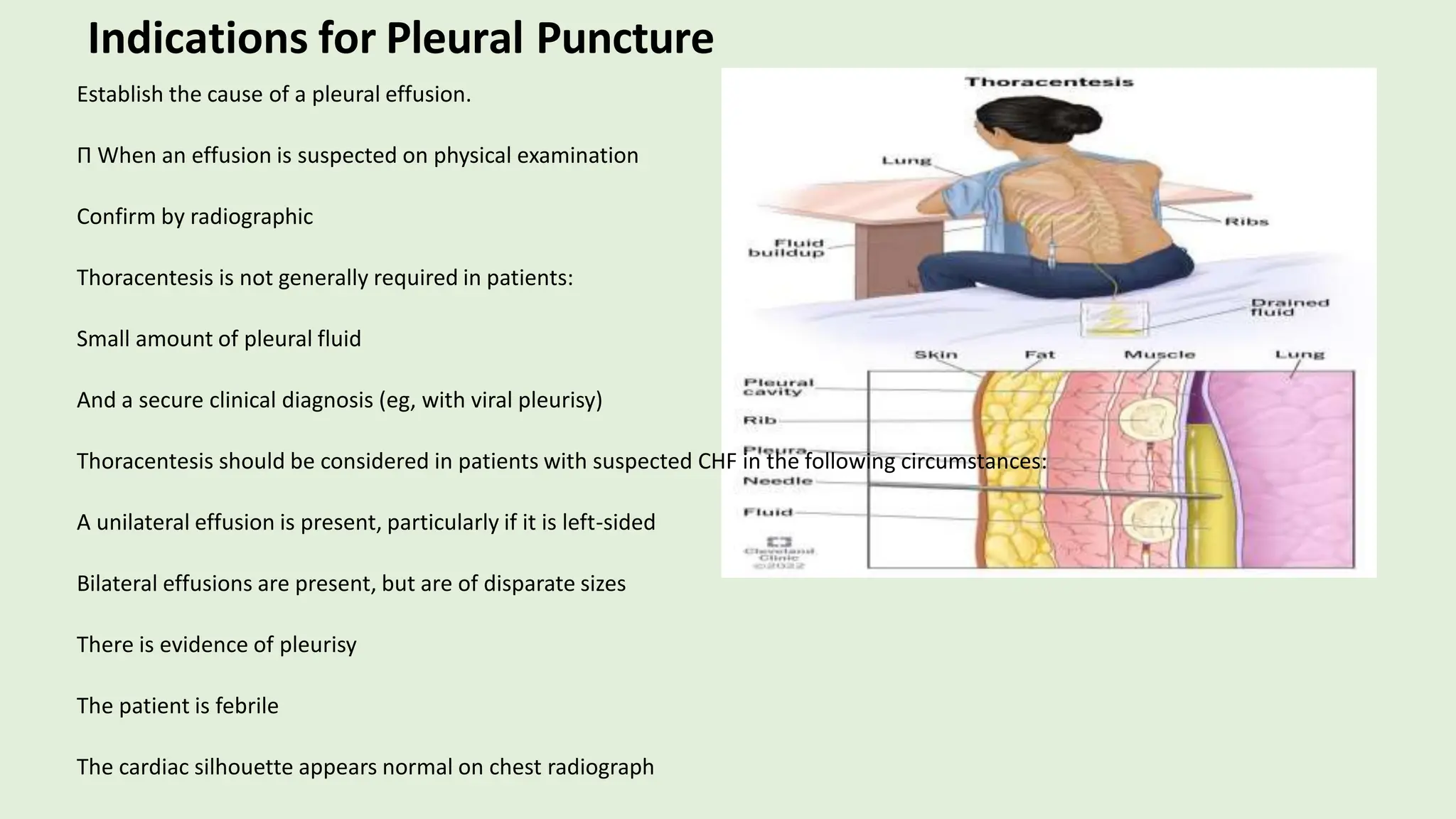 Pleuritis and pleural puncture ppt new by Tanu & Danish.pptx