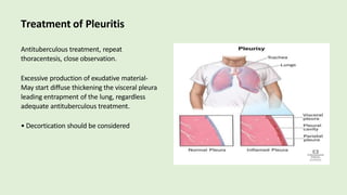 Pleuritis and pleural puncture ppt new by Tanu & Danish.pptx
