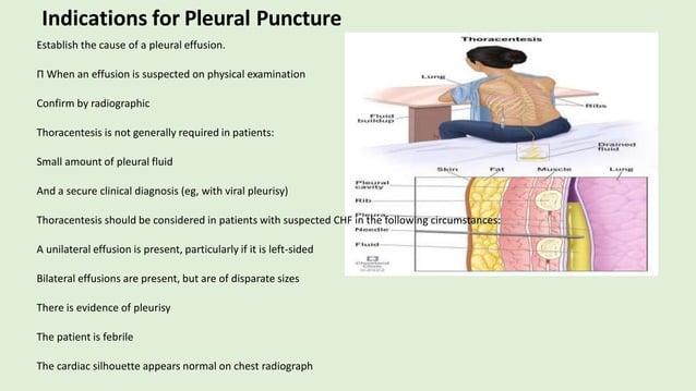 Pleuritis and pleural puncture ppt new by Tanu & Danish.pptx | Lung and ...