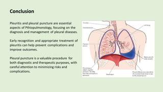 Pleuritis and pleural puncture ppt new by Tanu & Danish.pptx