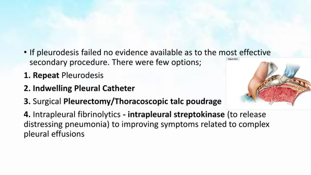 Pleurodesis in malignant pleural effusion.pdf