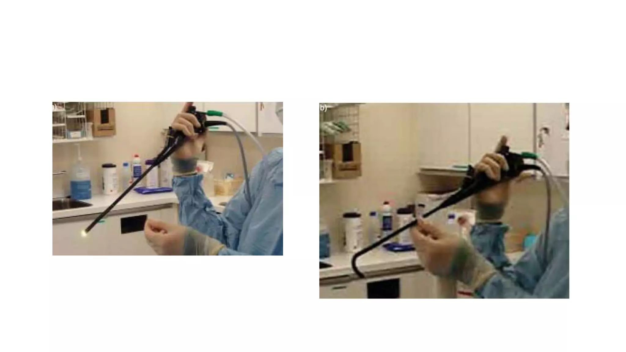 Pleuroscopy ppt by dr naseem ahmed | PPTX