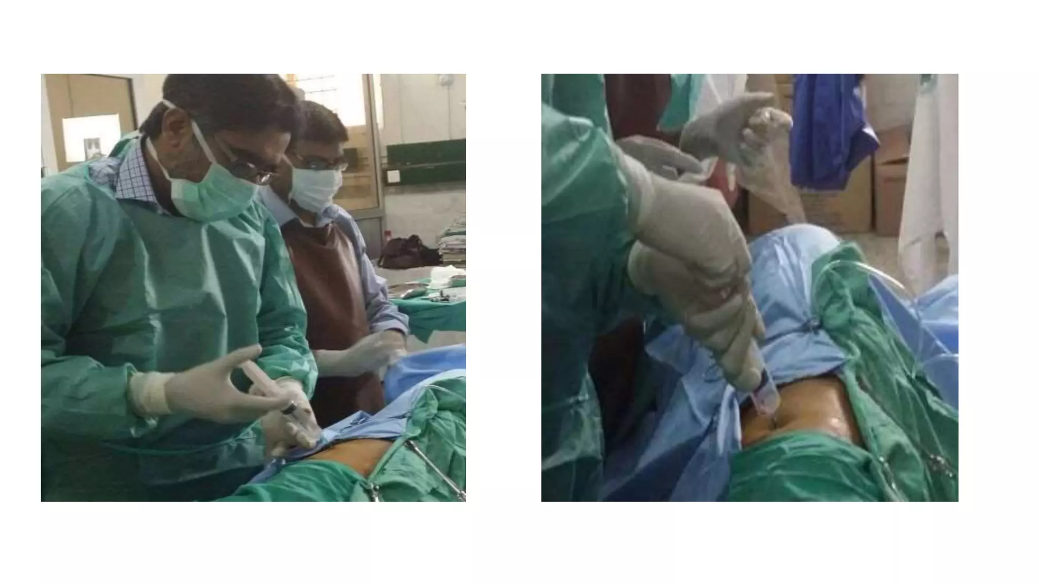 Pleuroscopy ppt by dr naseem ahmed | PPTX