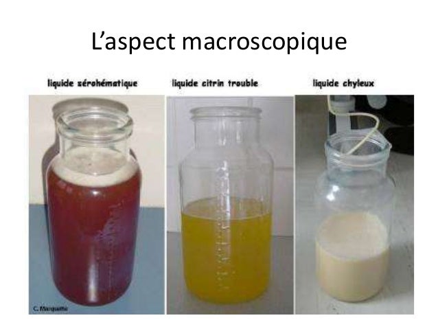 CAT devant une Pleurésie