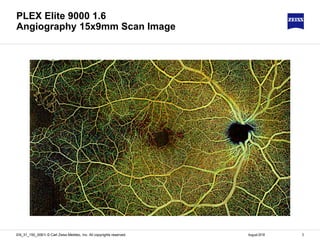 Plex elite OCTA | PPTX