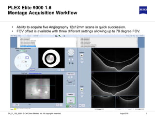 Plex elite OCTA | PPTX