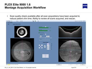 Plex elite OCTA | PPTX