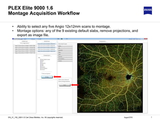 Plex elite OCTA | PPTX