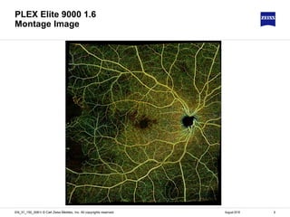 Plex elite OCTA | PPTX