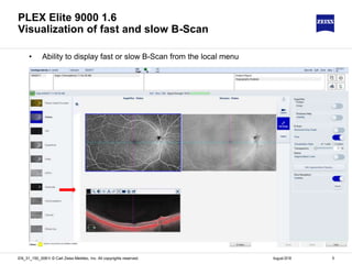 Plex elite OCTA | PPTX