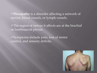 Plexopathy | PPTX