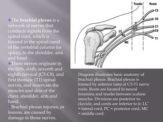 Plexopathy | PPTX