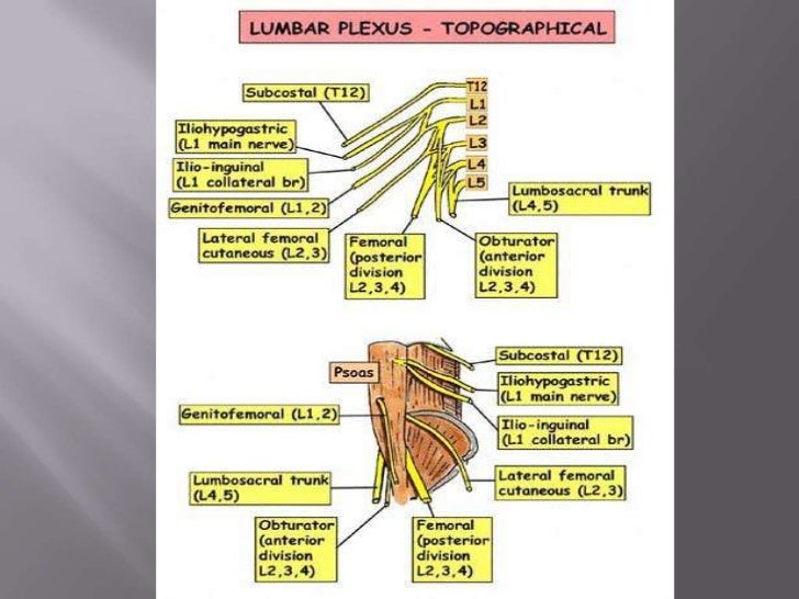 Plexopathy