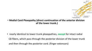 plexopathy Upper limb for rheumatologist | PDF