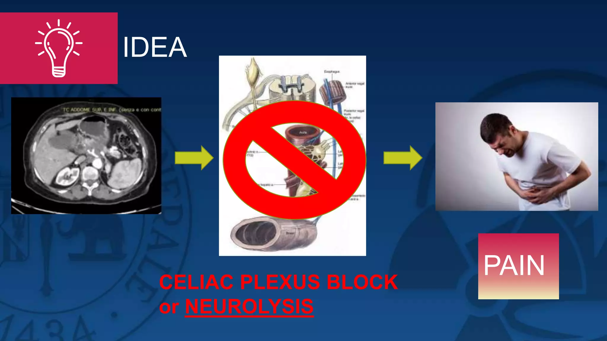 Plexus celiac neurolysis | PPTX