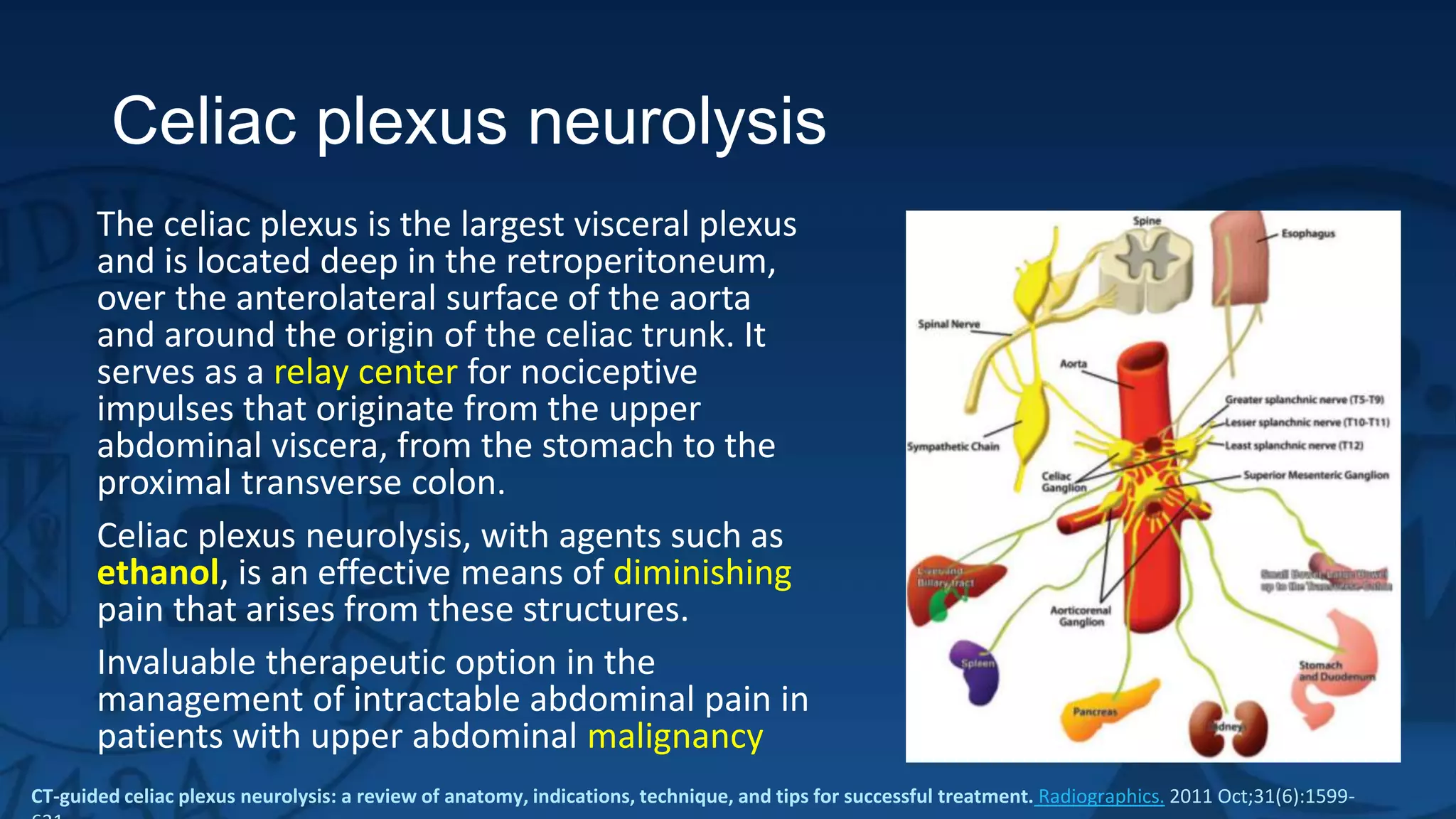 Plexus celiac neurolysis | PPTX