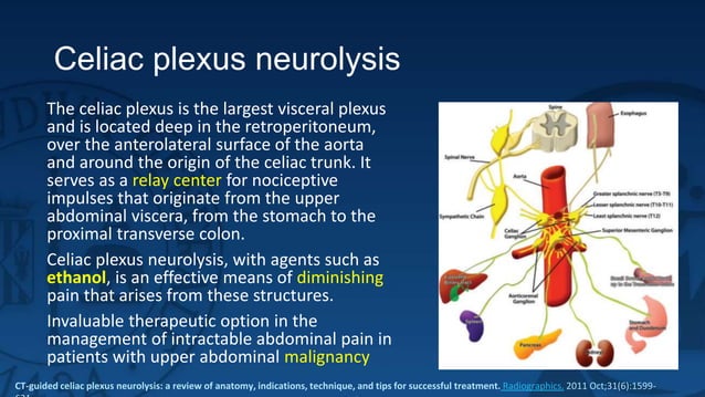Plexus celiac neurolysis