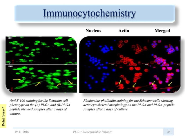 PLGA: an biodegradable polymer | PPTX | Chemistry | Science