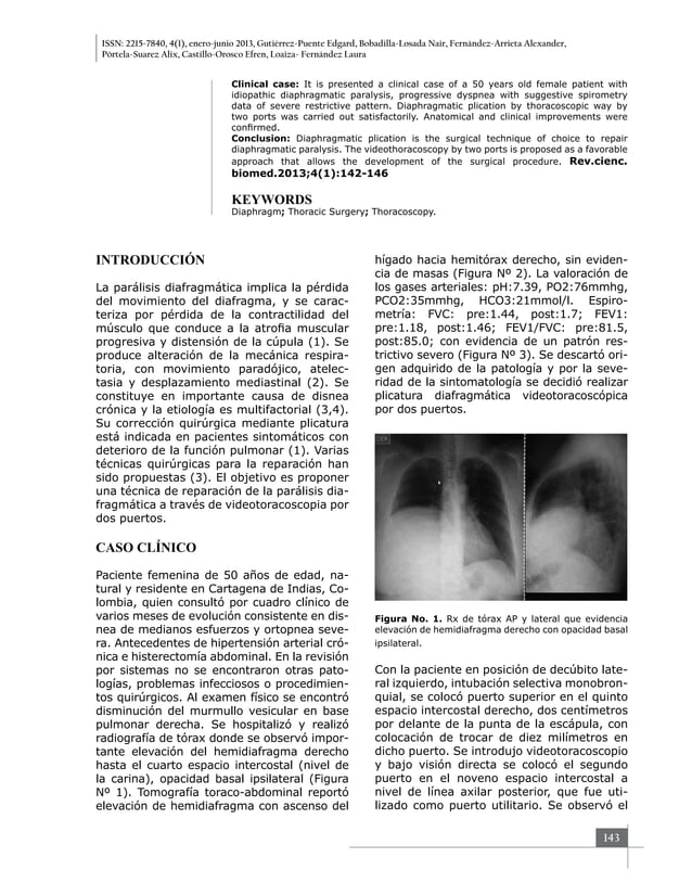 Plicatura del musculo diafragma por toracoscopia por dos puertos | PDF