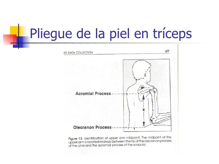 Pliegues SubcutáNeos