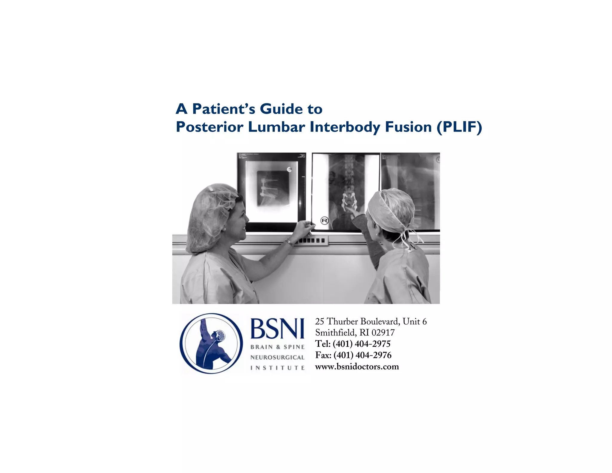 Posterior Lumbar Interbody Fusion | PDF