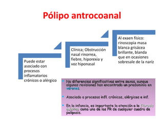 Pólipo antrocoanal.pptx