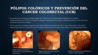 Pólipos intestinales.pptx