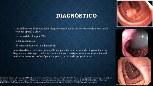 Pólipos intestinales.pptx