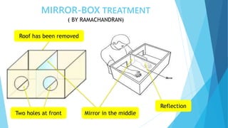 Phantom-limb Pain | PPTX