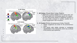 Phantom Limb Pain (PLP) | PPTX