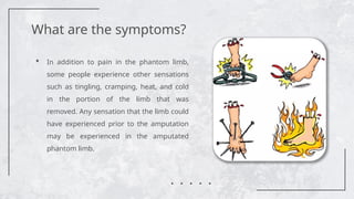 Phantom Limb Pain (PLP) | PPTX
