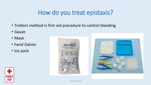 PLT Epistaxis.pptx | First Aid | Injuries