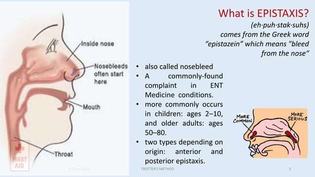 PLT Epistaxis.pptx | First Aid | Injuries