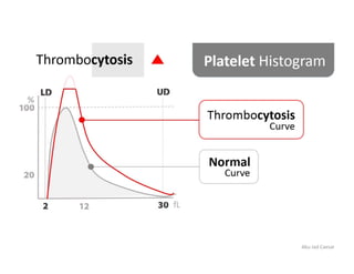 Platelets Histogram | PDF