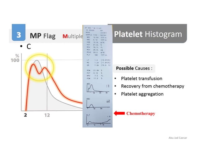Platelets Histogram | PDF