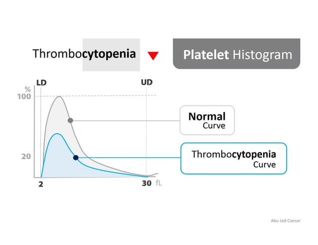 Platelets Histogram