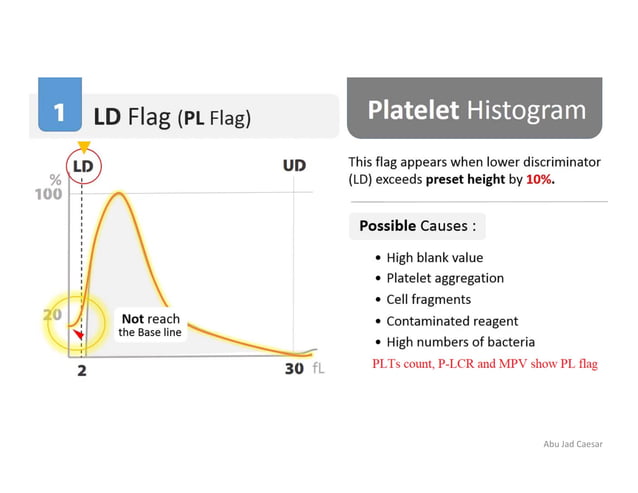 Platelets Histogram