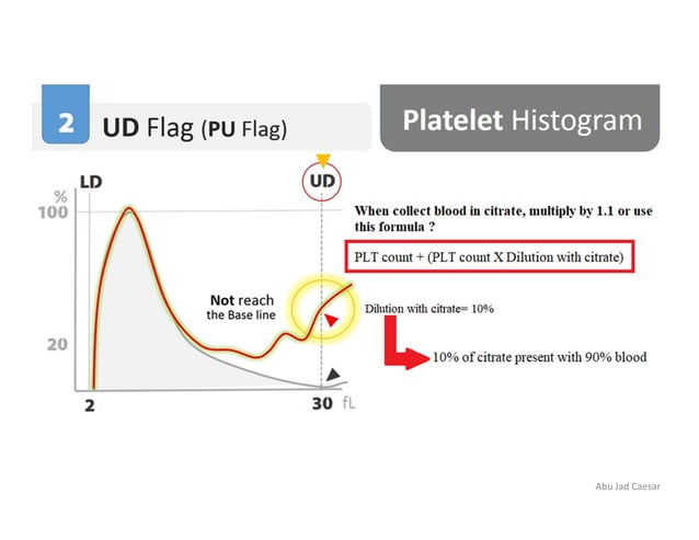 Platelets Histogram